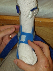 Instructions for Articulating or Solid Ankle AFO – Pediatric Orthotic ...